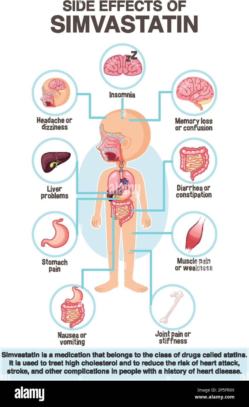 Human anatomy diagram cartoon style of simvastatin side effects ...
