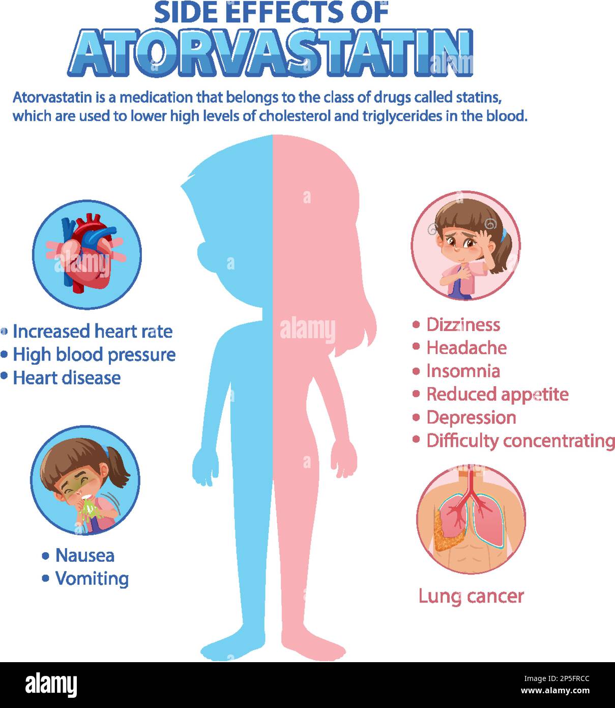 Human anatomy diagram cartoon style of Atorvastatin side effects ...