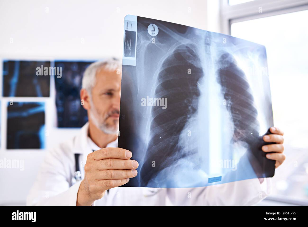 Diagnosing the problem. a mature male doctor looking at a x-ray image ...