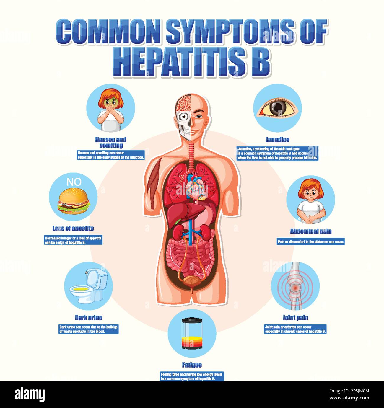 Informative poster of common symptoms Hepatitis B illustration Stock ...
