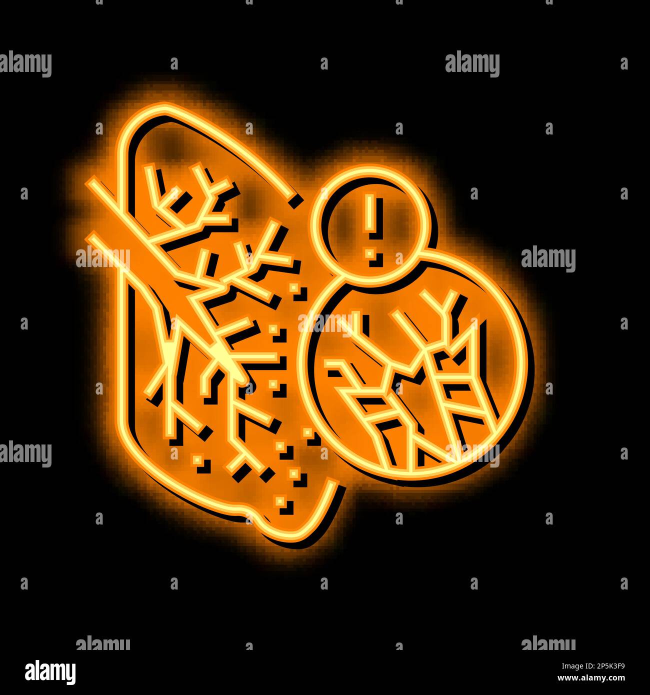 lung with asbestos neon glow icon illustration Stock Vector Image & Art - Alamy