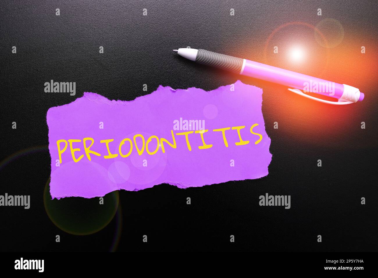 Handwriting text Periodontitis. Concept meaning Swelling of the tissue ...