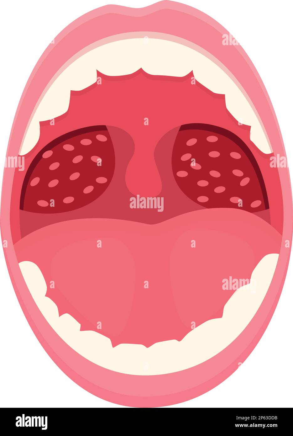 Mouth infection icon cartoon vector. Hygiene inflammation. Medical ...