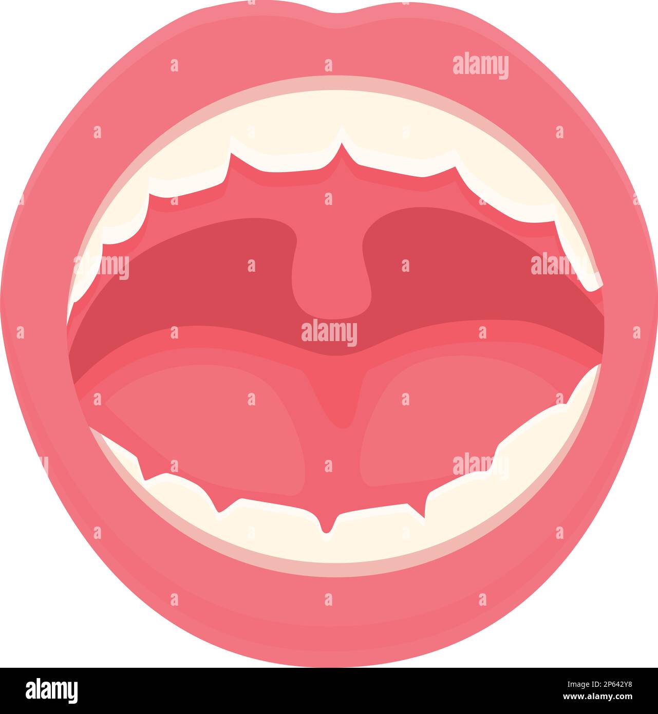 Aphthous Stomatitis On Uvula