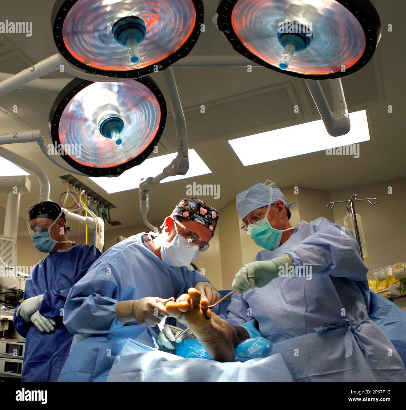 Dr. Charles Zelen, center, operates on Anderson Mambwe's left foot on ...