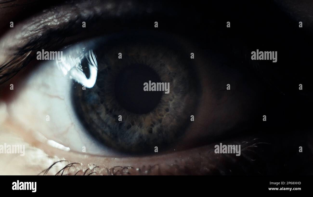 Green eye close-up with capillaries. Frightened look. The concept of ...
