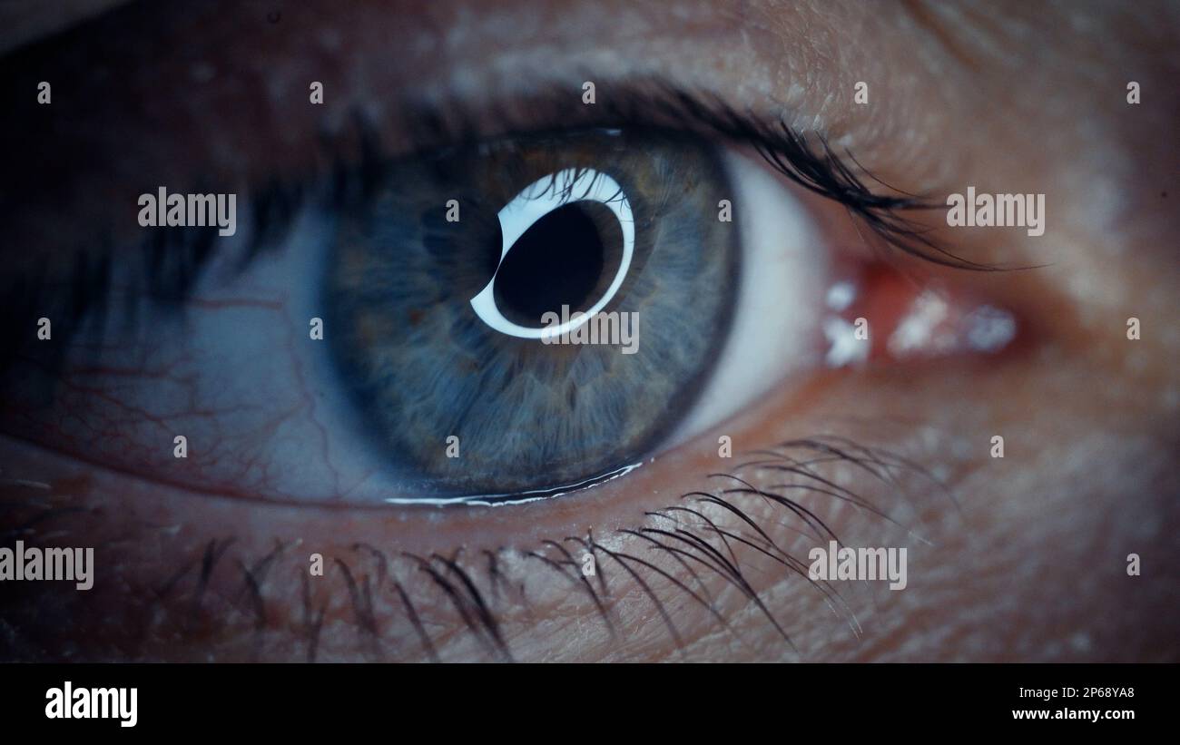 Green eye close-up with capillaries. Frightened look. The concept of ...