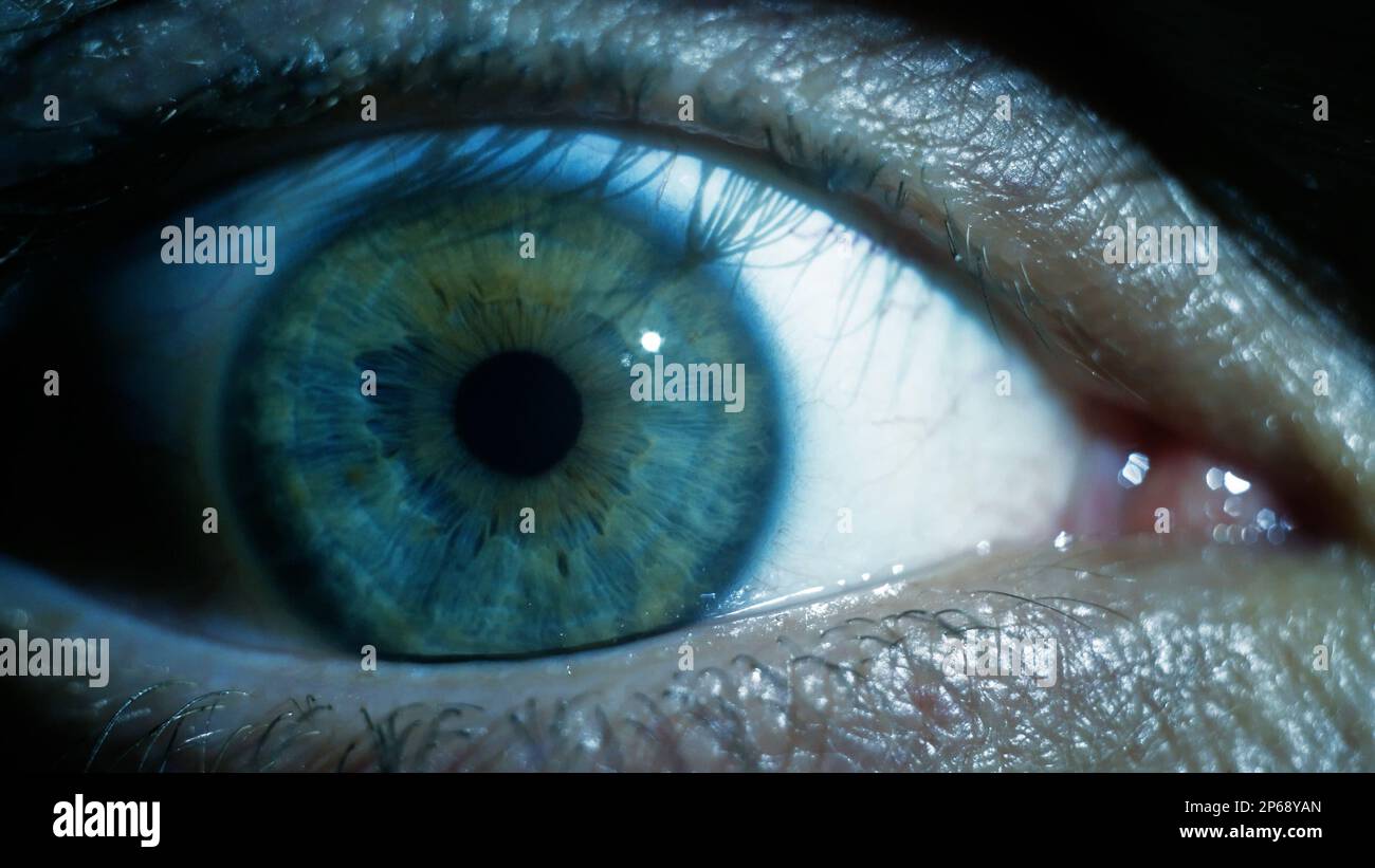 Green eye close-up with capillaries. Frightened look. The concept of ...