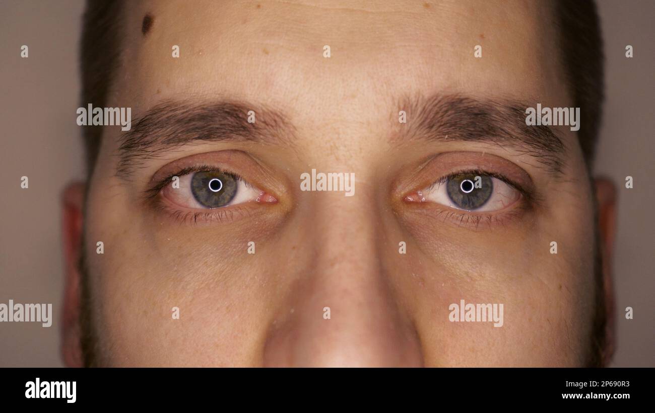 Green eyes close-up with capillaries. The concept of ophthalmology and ...