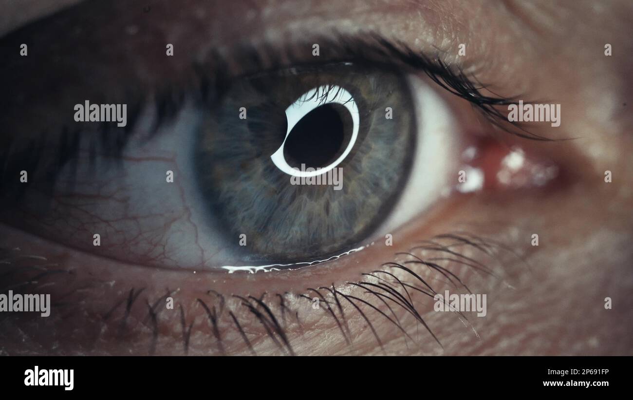 Green eye close-up with capillaries. The concept of ophthalmology and ...