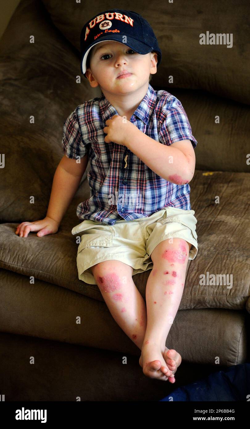 Seen in a June 13, 2012 photo, two-year-old Gabriel Eubanks of Crane ...