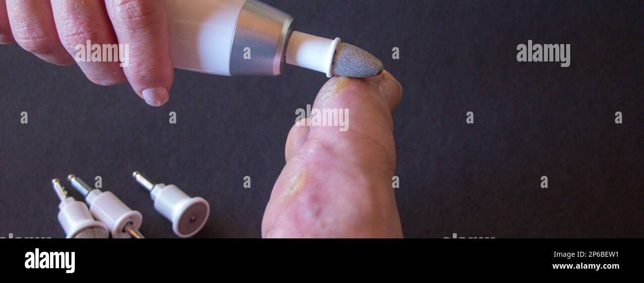 Image of a mini drill used by a beautician as she removes dead skin ...
