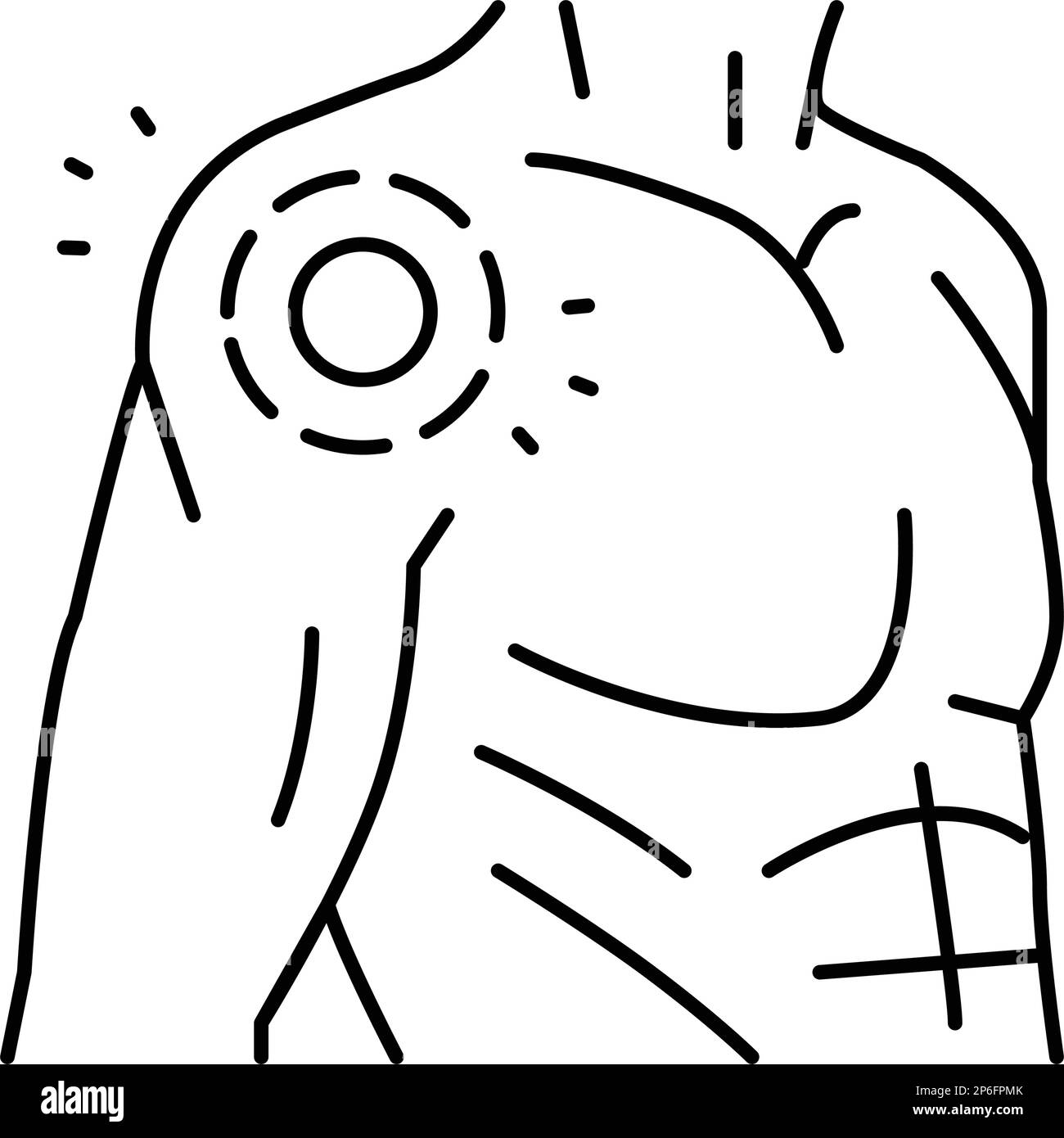 Painful shoulder joint illustration Black and White Stock Photos ...