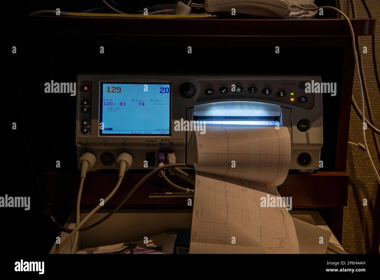 Labor contractions graph hi-res stock photography and images - Alamy