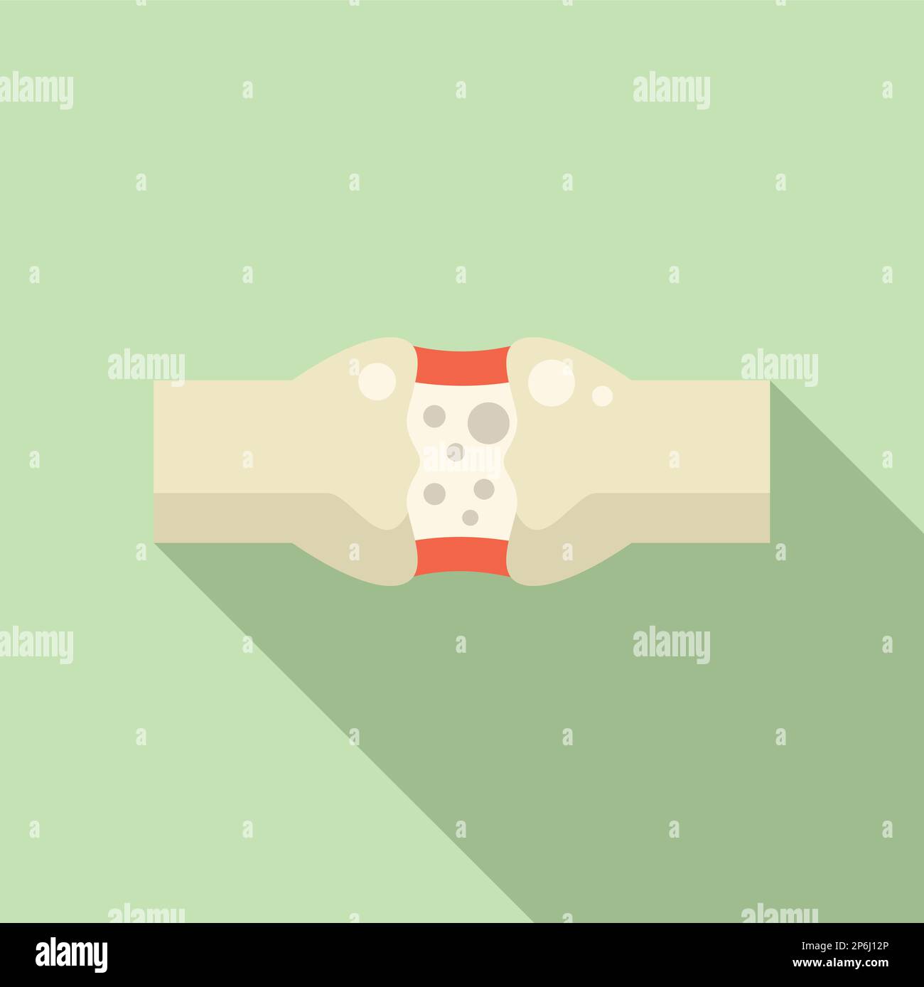 Wrist osteoarthritis Stock Vector Images - Alamy