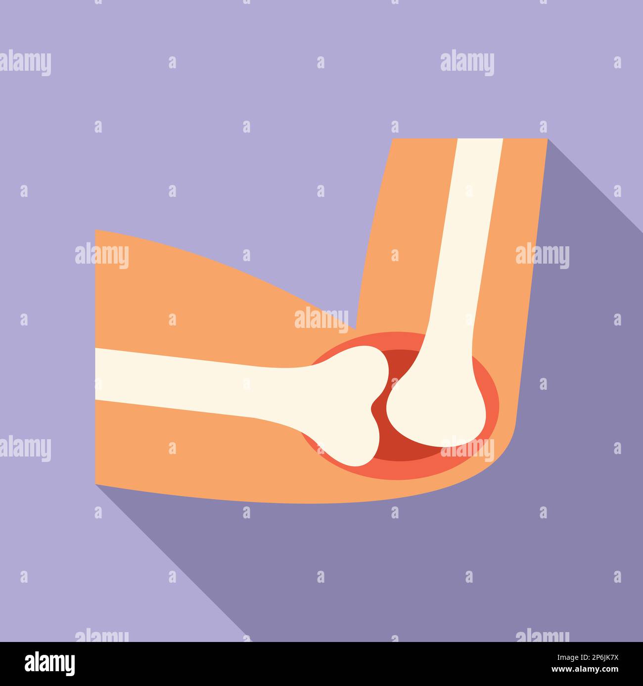 Elbow injury icon flat vector. Medical pain. Body pain Stock Vector ...