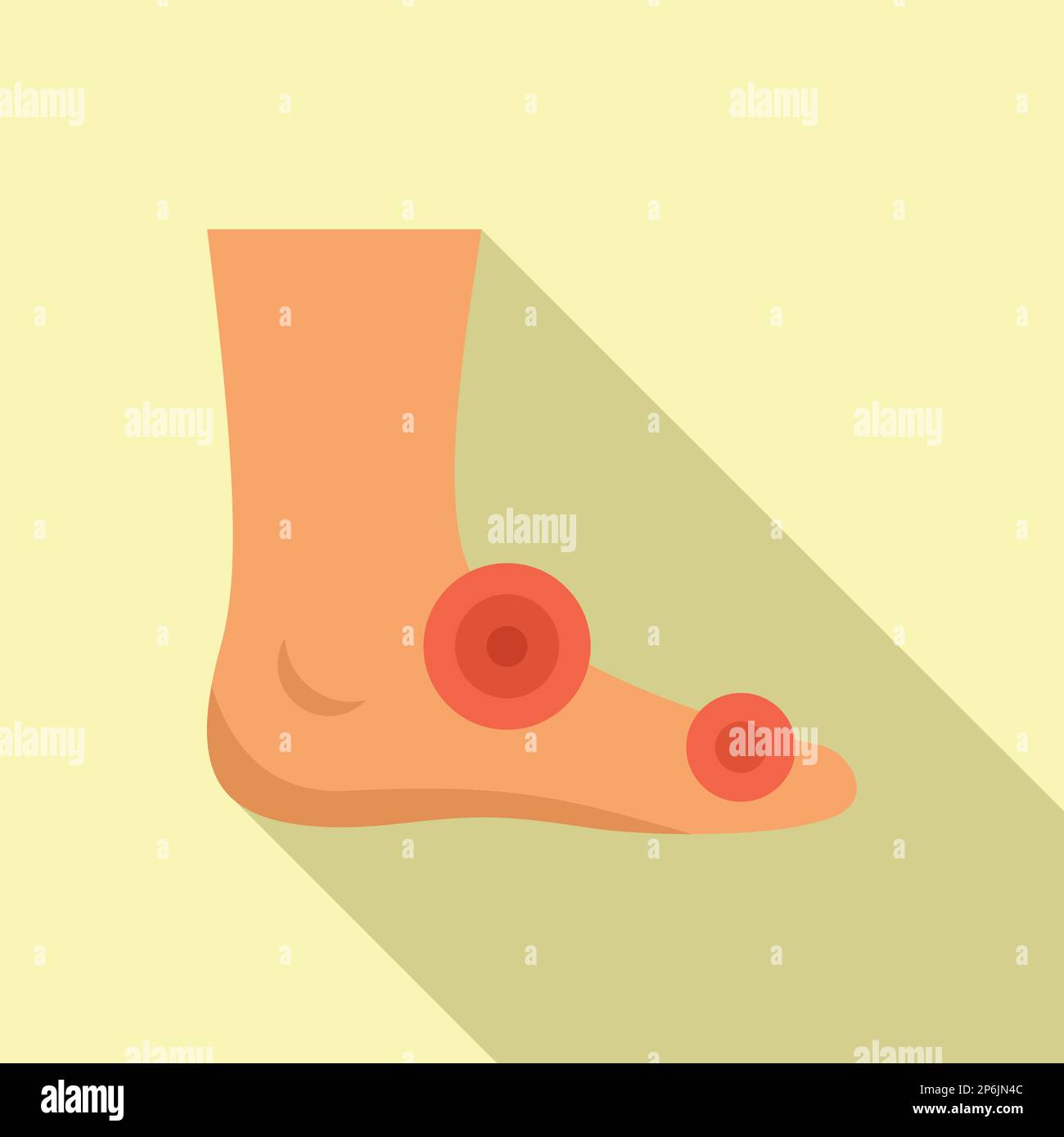 Foot injury icon flat vector. Medical pain. Hospital inflammation Stock ...