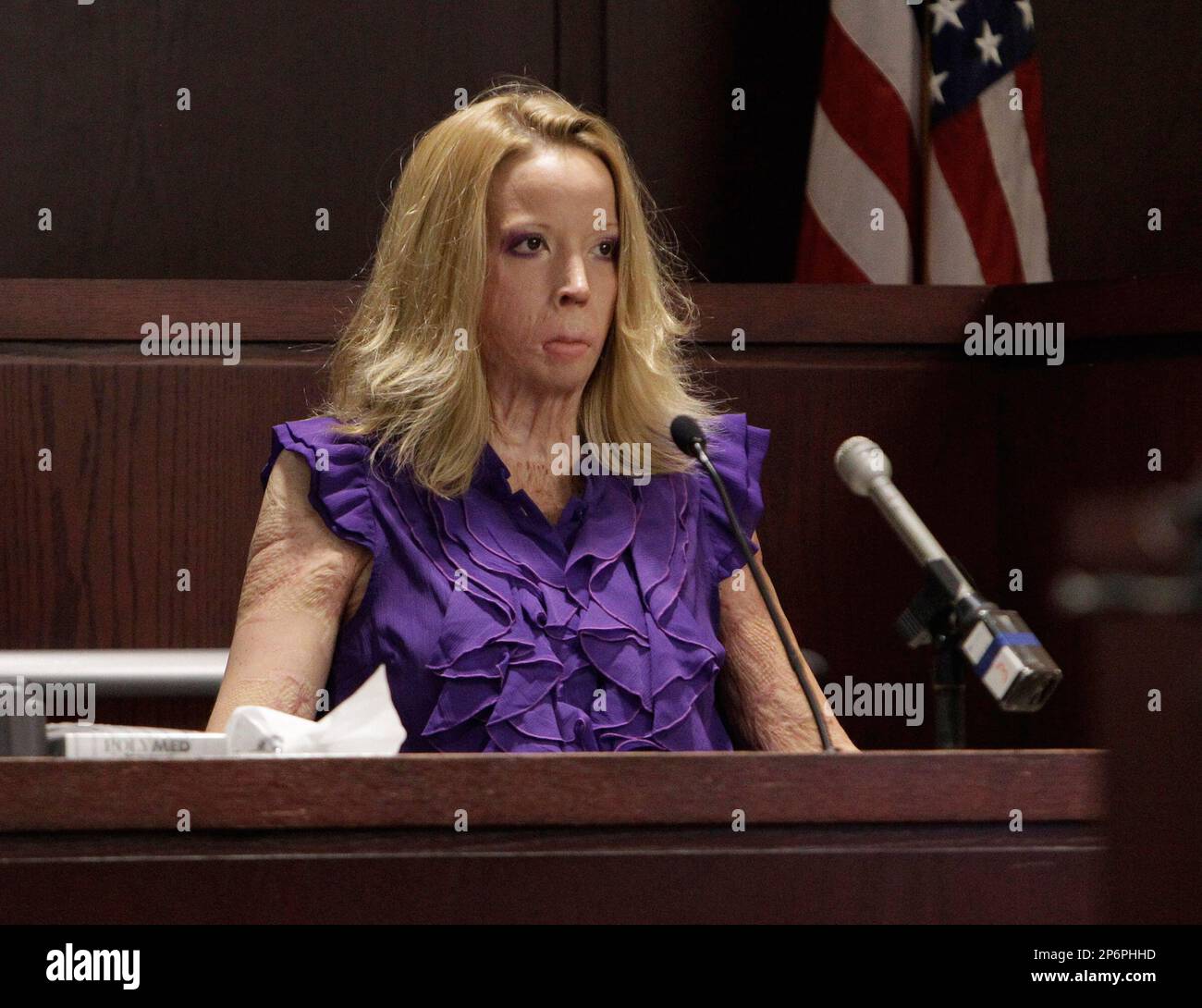 Burn victim Audrey Mabrey testifies in the trial of Christopher Hanney ...