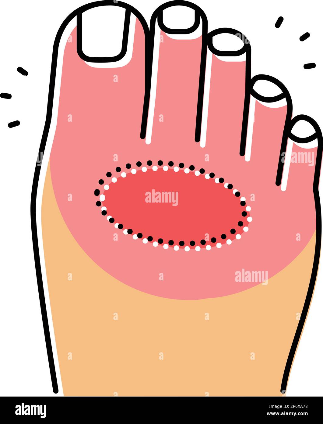 toe pain body ache color icon vector illustration Stock Vector Image ...