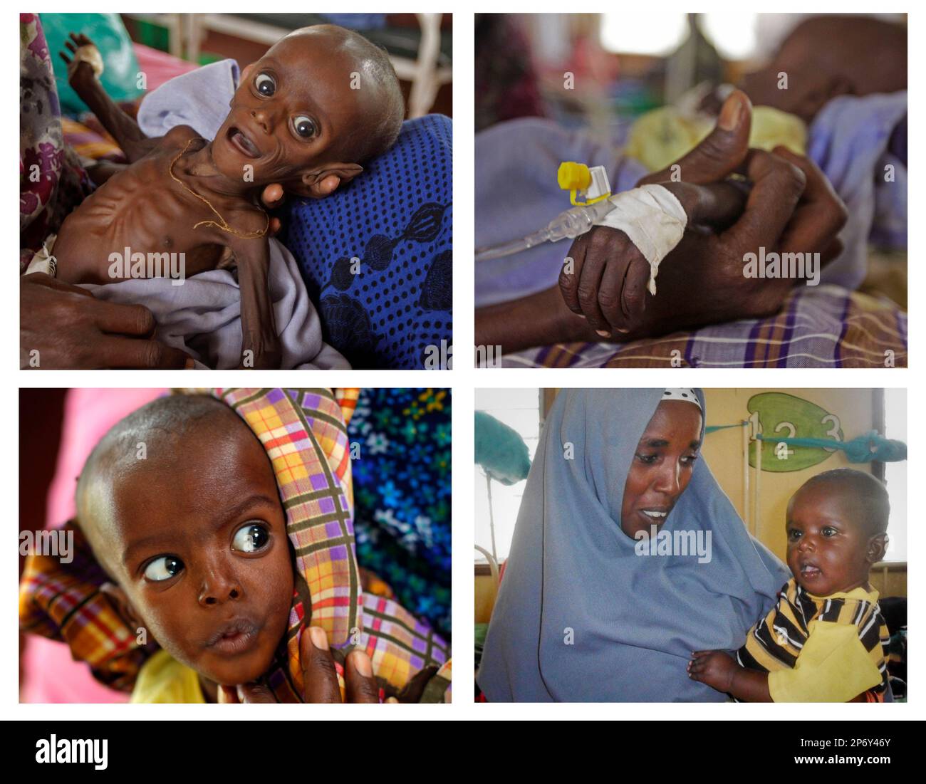 FILE - This composite image shows baby Minhaj Gedi Farah at various ...