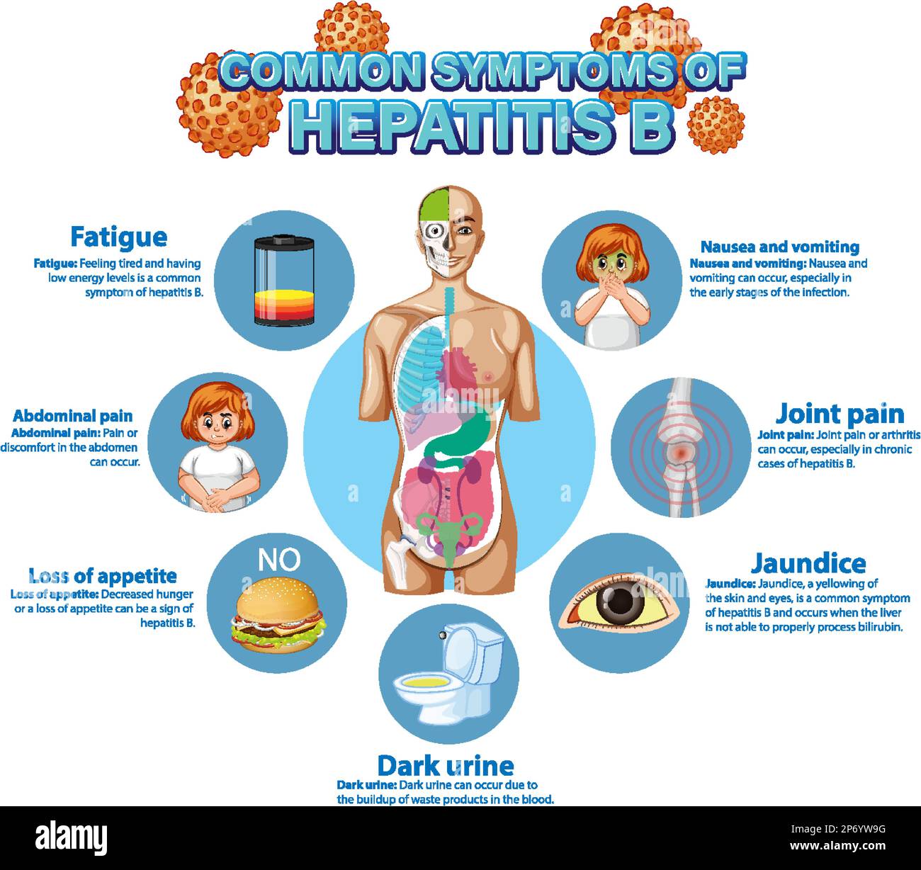 Informative poster of common symptoms Hepatitis B illustration Stock ... Informative poster of common symptoms Hepatitis B illustration Stock ...