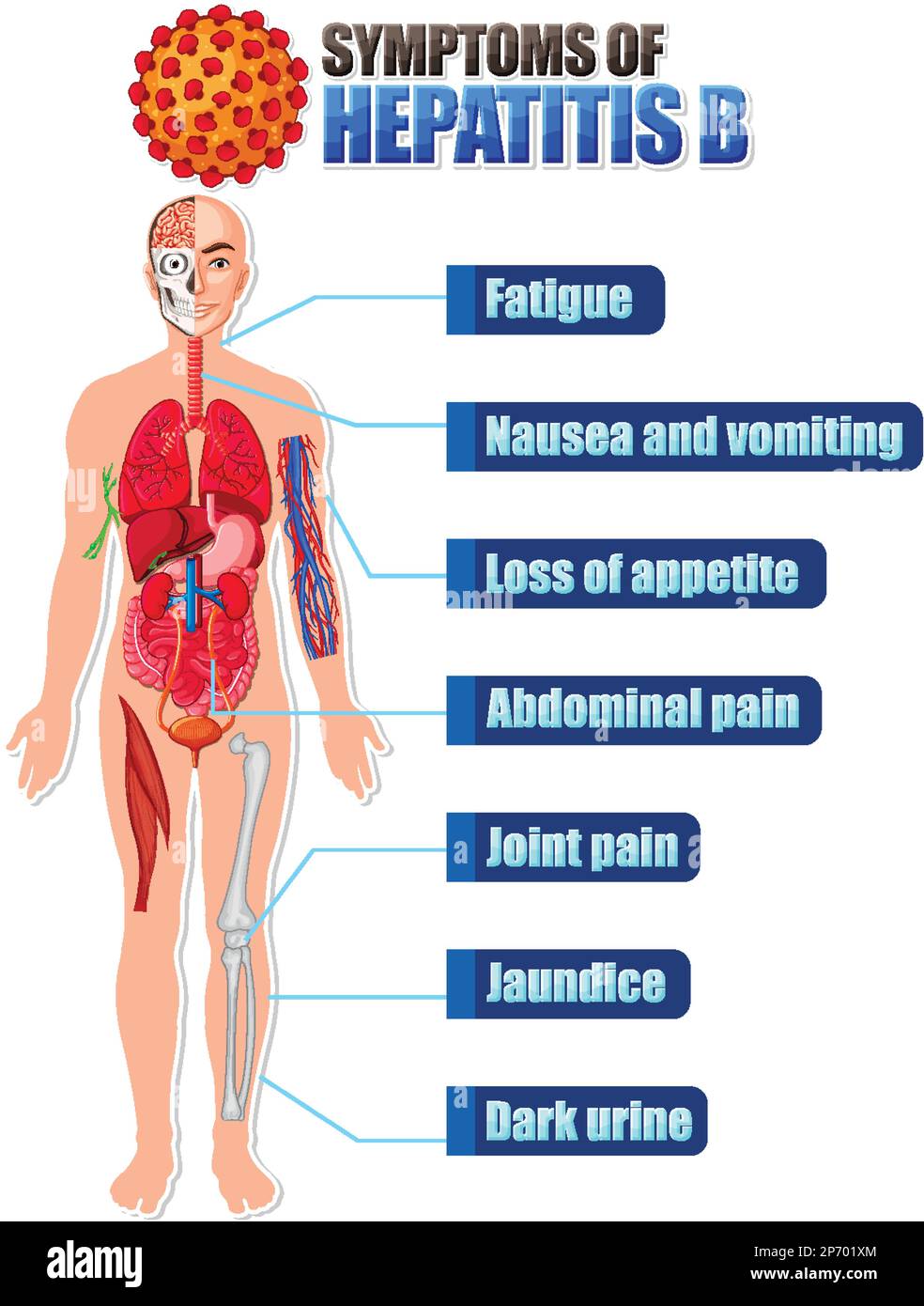 Informative poster of common symptoms Hepatitis B illustration Stock Vector Image & Art - Alamy