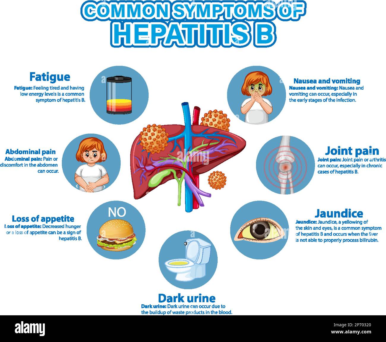 Informative poster of common symptoms Hepatitis B illustration Stock ...