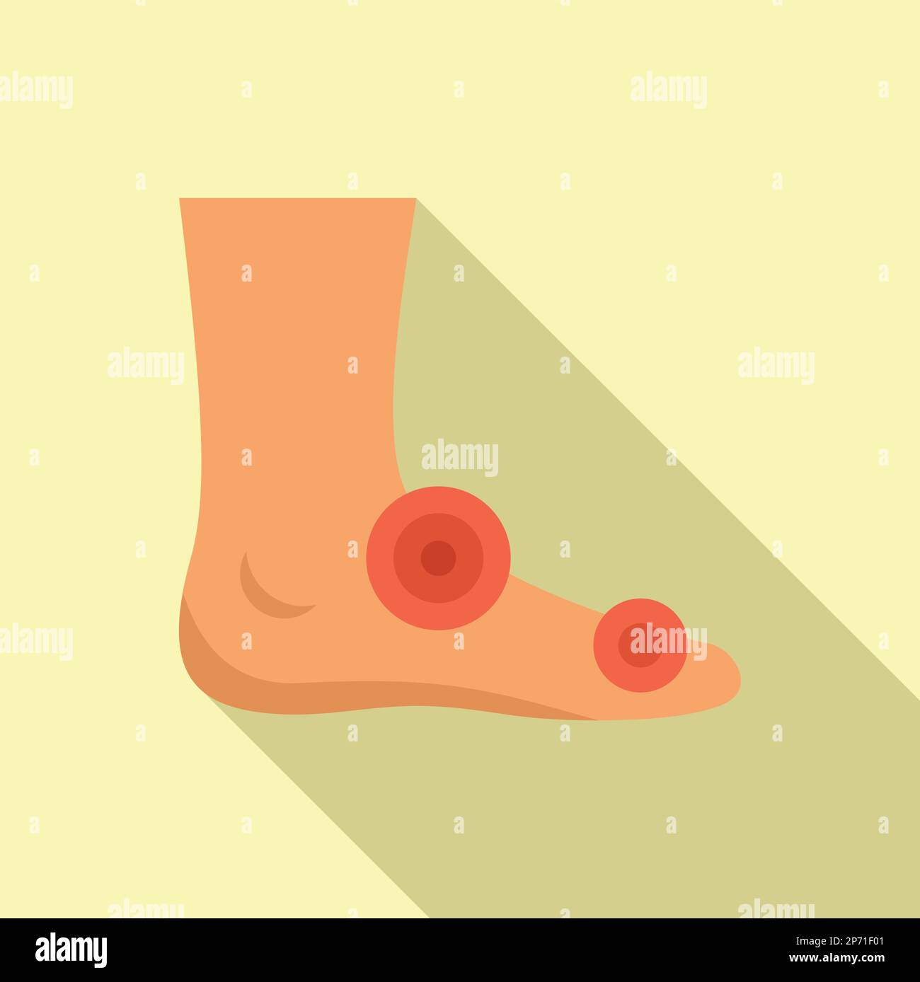 Foot injury icon flat vector. Medical pain. Hospital inflammation Stock ...