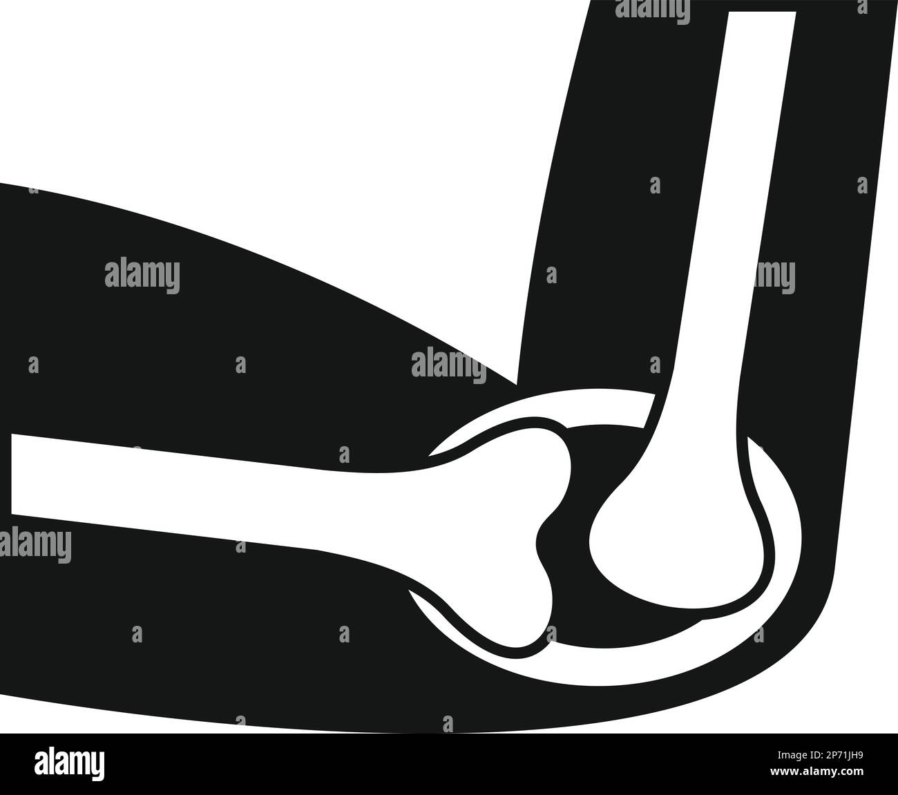 Elbow injury icon simple vector. Medical pain. Body pain Stock Vector ...