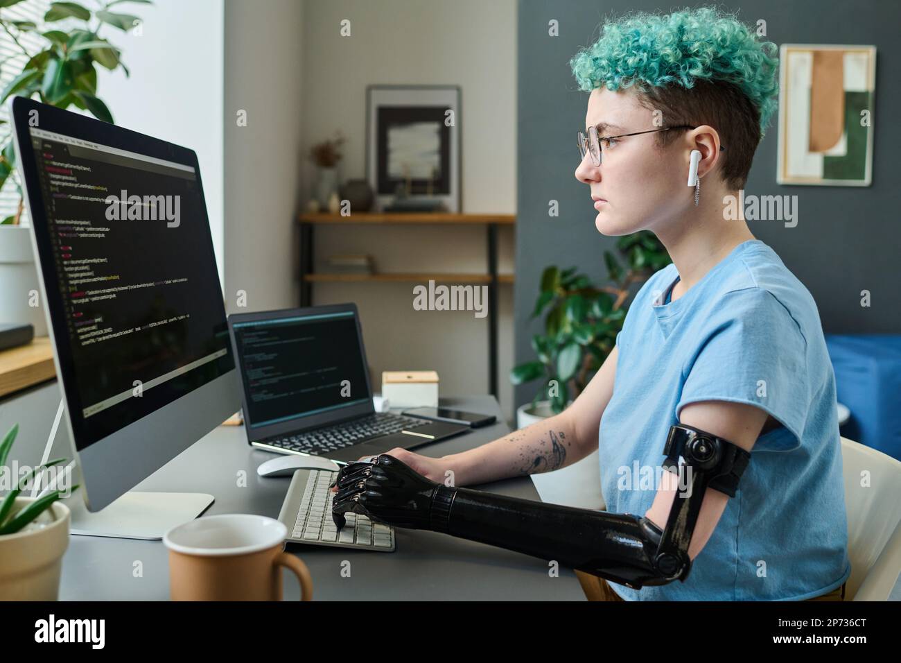 Young IT specialist with prosthetic arm concentrating on her online work, she working with ...