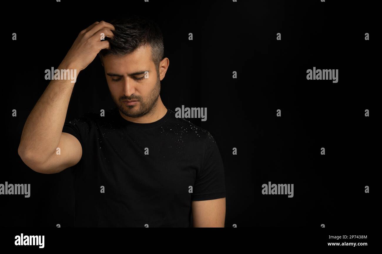 Close up low key portrait of man with dandruff or itchy hair problem ...