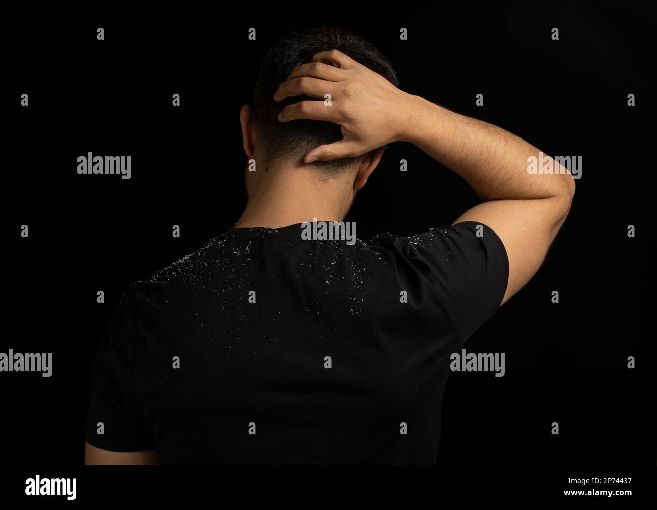 Close up low key portrait of man with dandruff or itchy hair problem ...