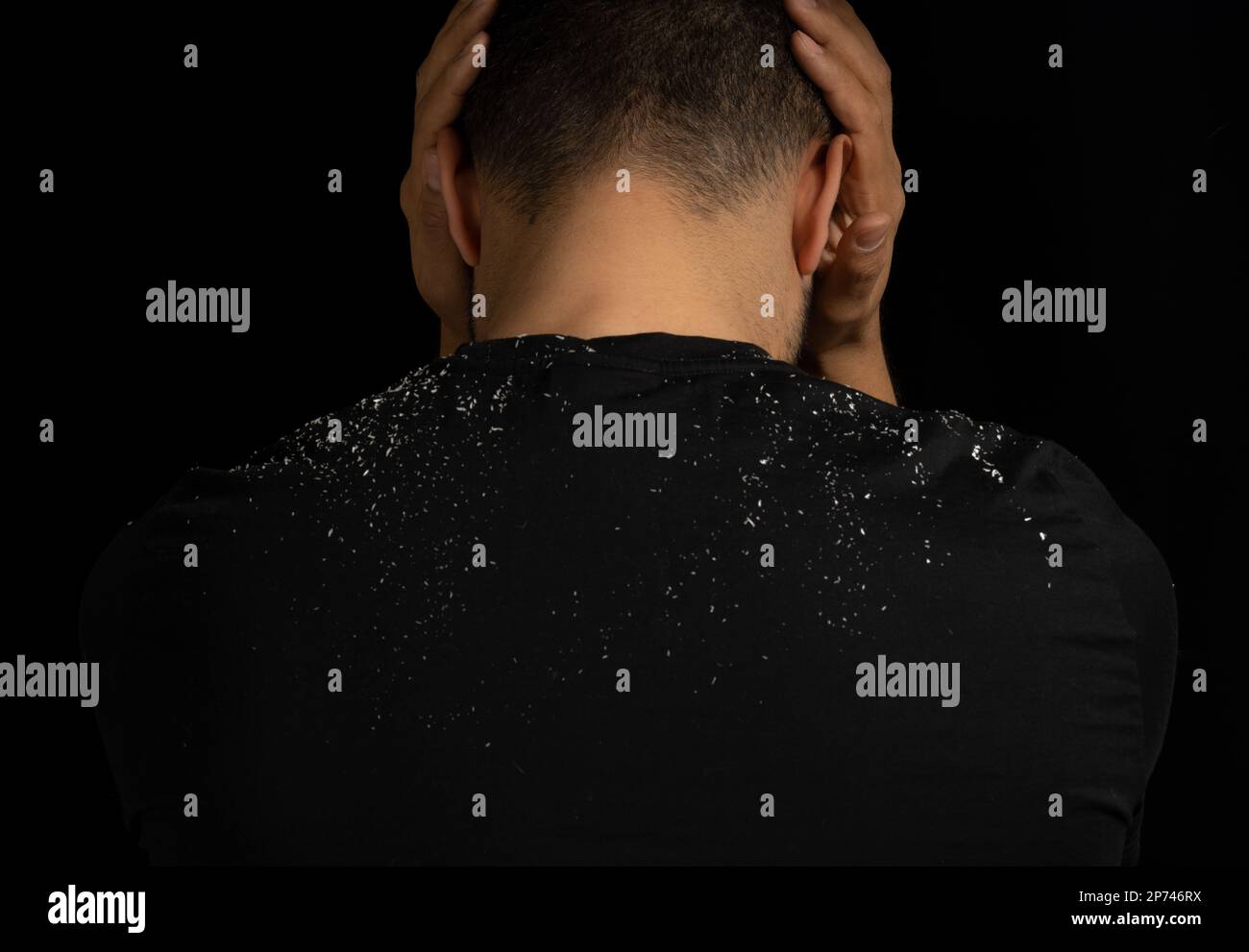 Close up low key portrait of man with dandruff or itchy hair problem ...