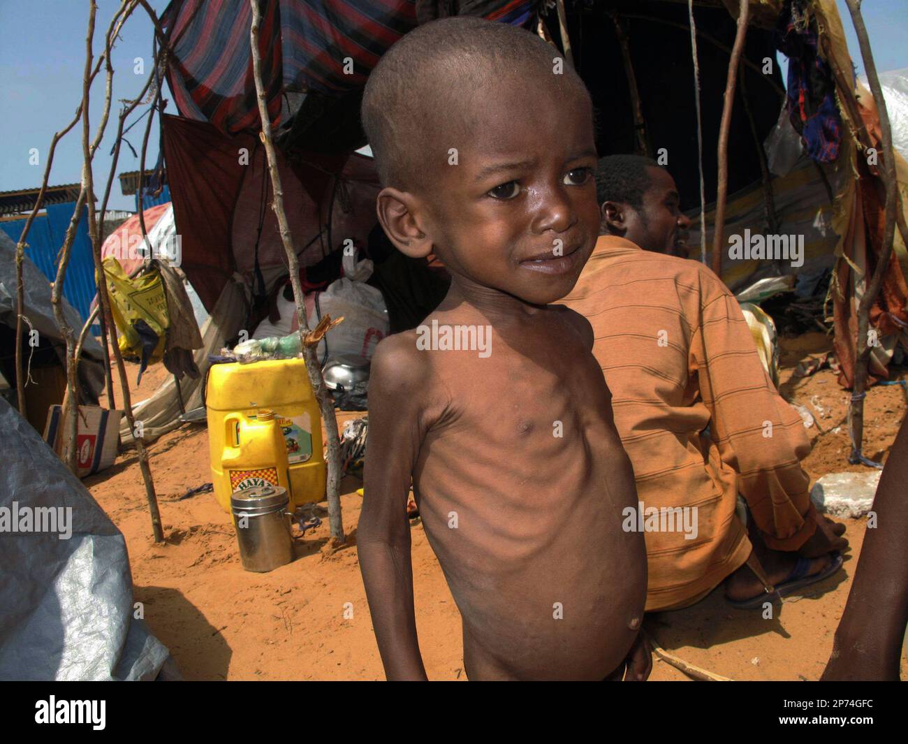 Skinny People In Africa