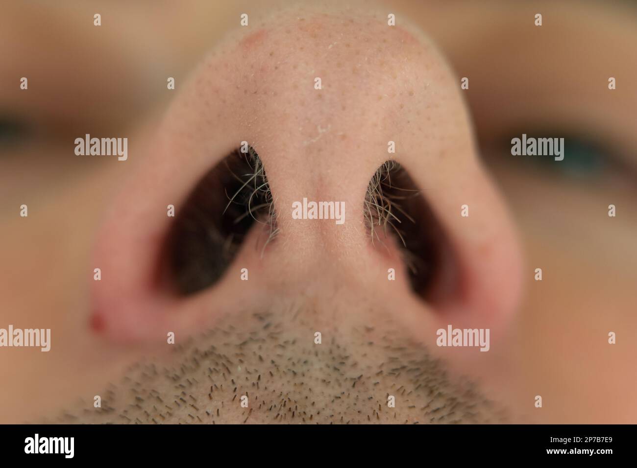 Caucasian male unkempt nose hair follicles macro close up shot. Close ...