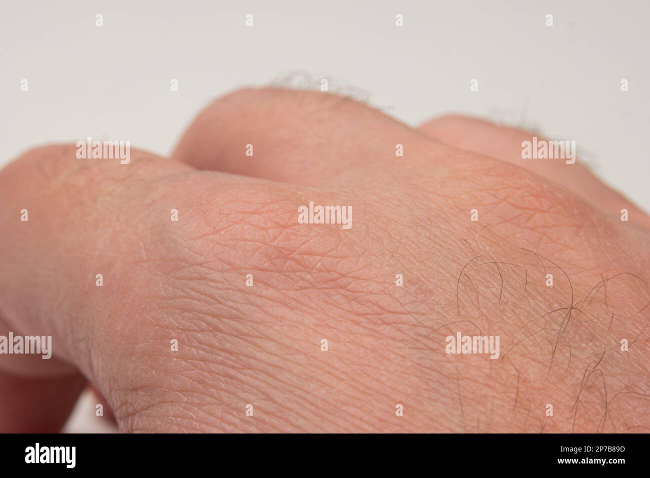 Caucasian male hand with black hair follicles macro close up shot Stock ...