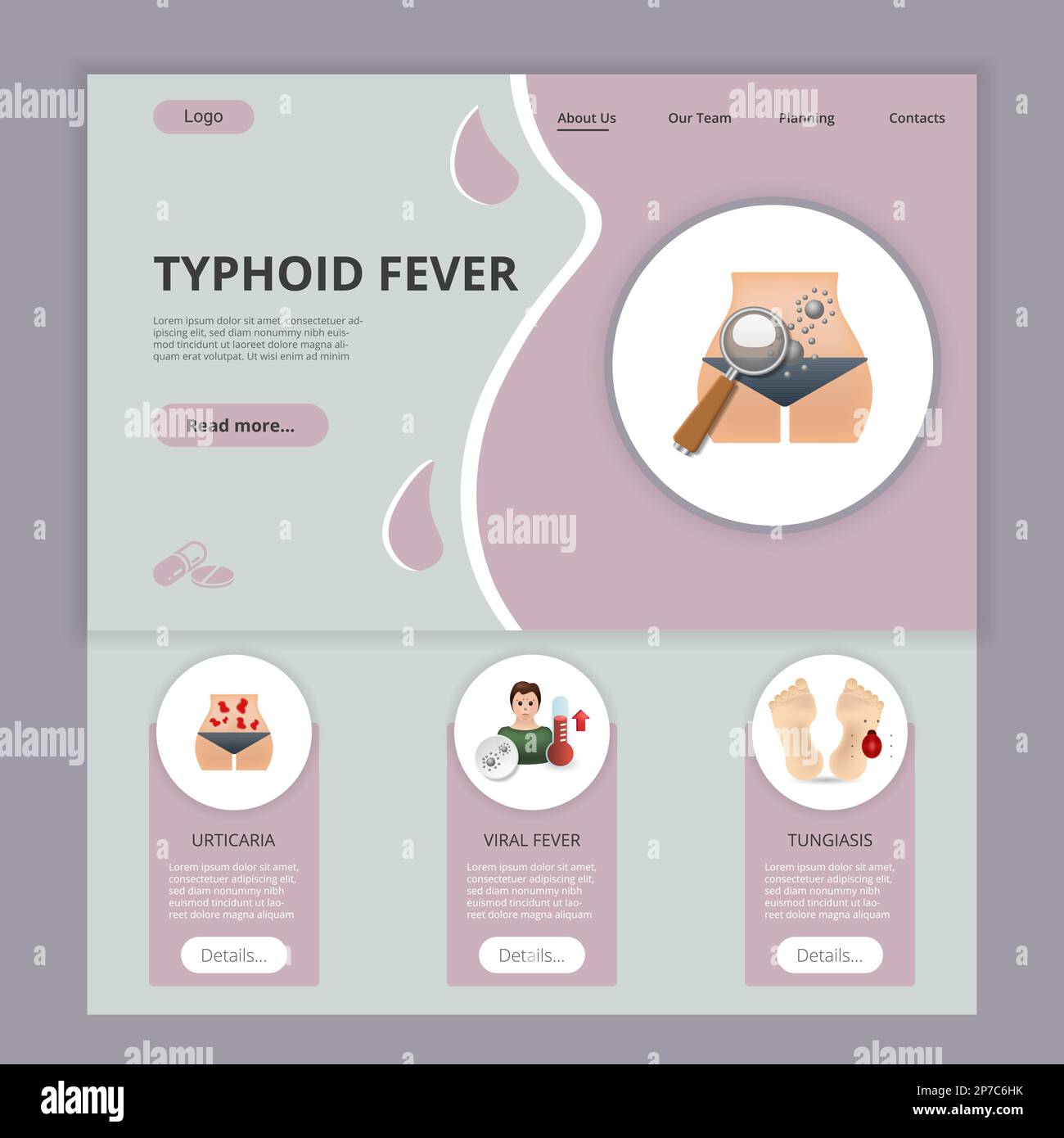 Typhoid fever flat landing page website template. Urticaria, viral ...