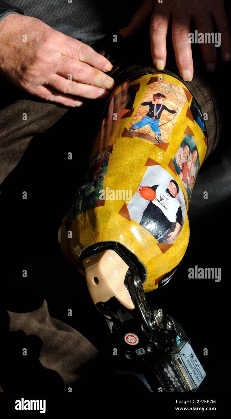 In this Jan. 11, 2010 photo, Danny Gates shows his custom prosthetic ...