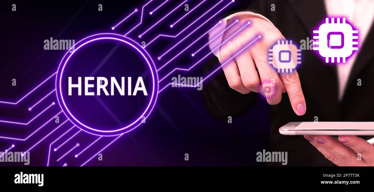 Conceptual caption Hernia. Word Written on Abnormal exit of tissue or ... Conceptual caption Hernia. Word Written on Abnormal exit of tissue or ...