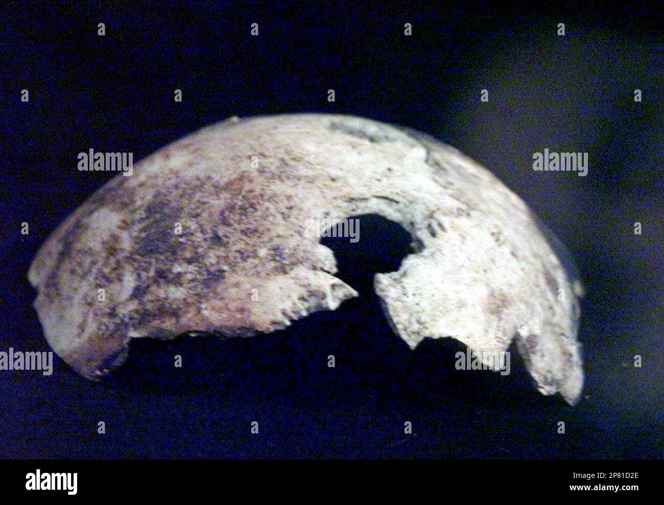 FILE- This April 26, 2000 file photo shows a skull fragment with a ...