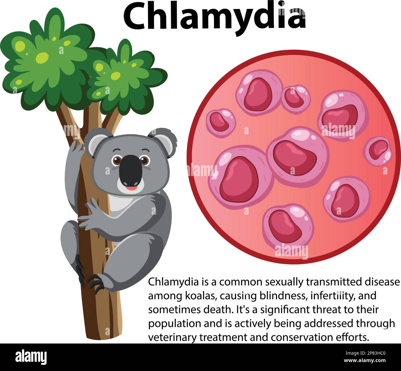 Chlamydia trachomatis with explanation illustration Stock Vector Image ...