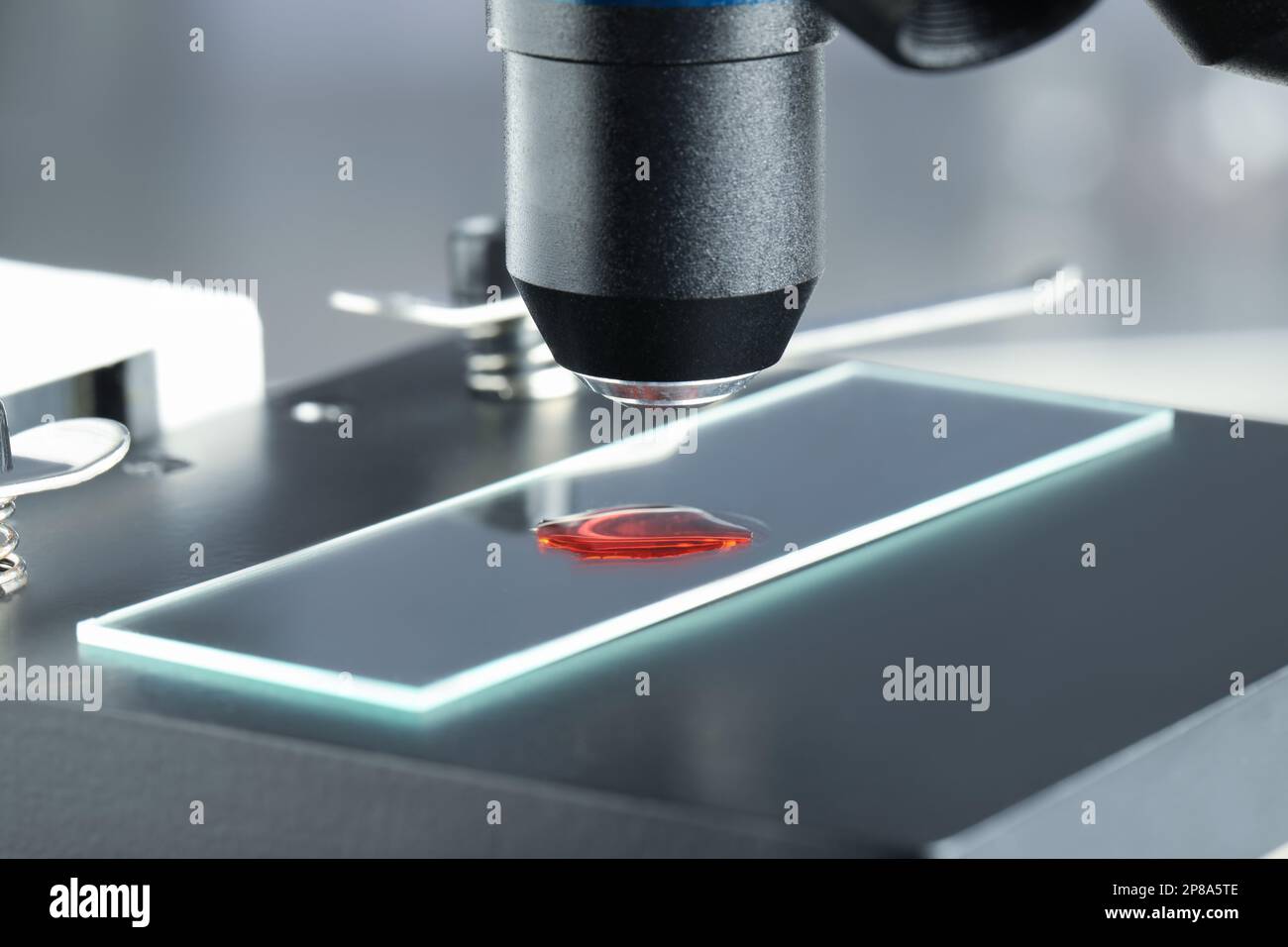 Cytology slide hi-res stock photography and images - Alamy