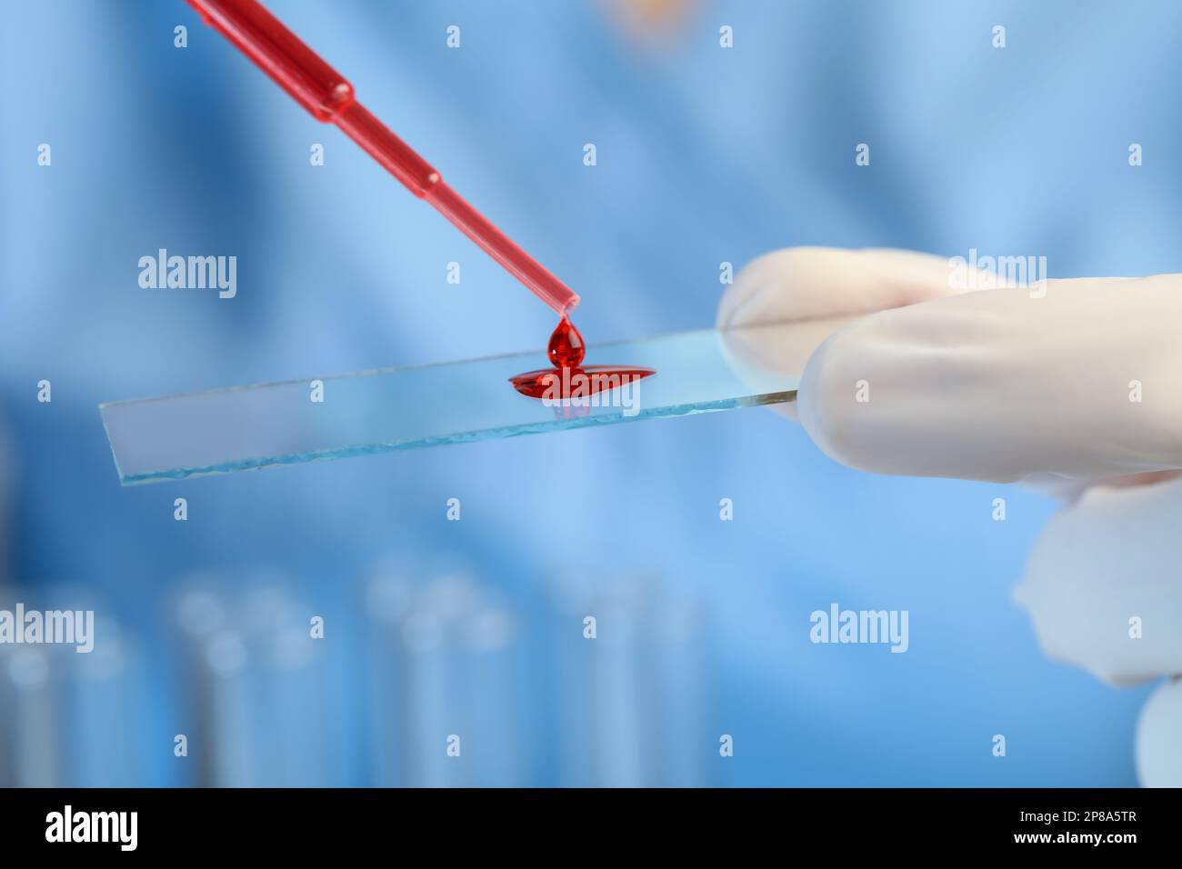 Microscope slide blue sample blood sample hi-res stock photography and ...