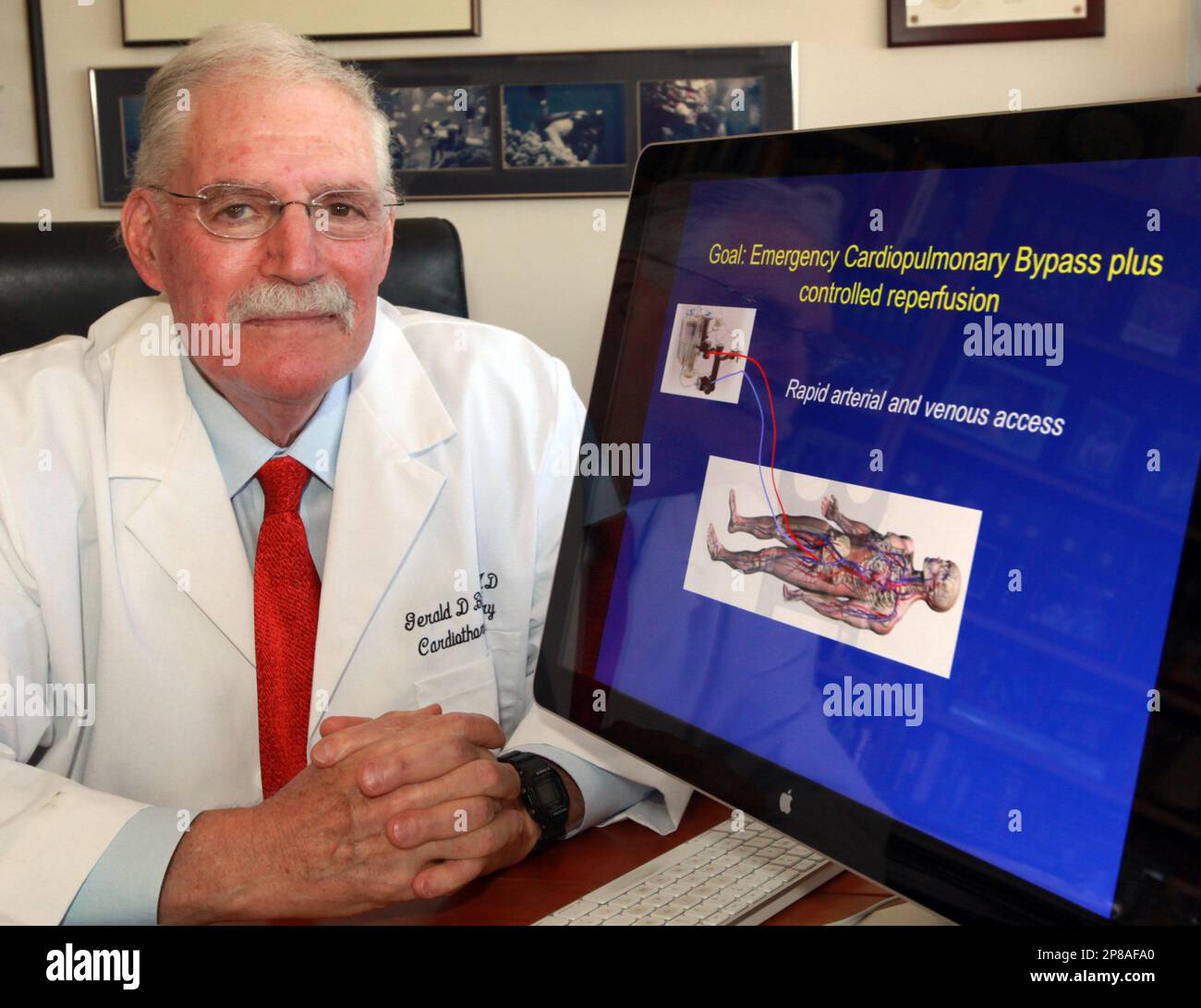 Dr. Gerald Buckberg, a cardiac surgeon at UCLA, poses next to a ...