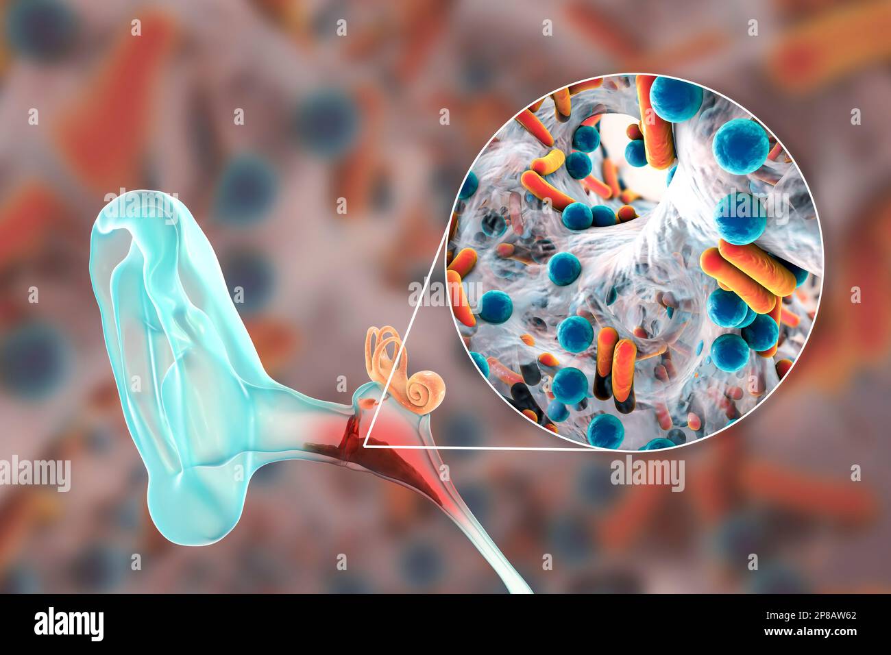 Streptococcus pyogenes s pyogenes hi-res stock photography and images ...