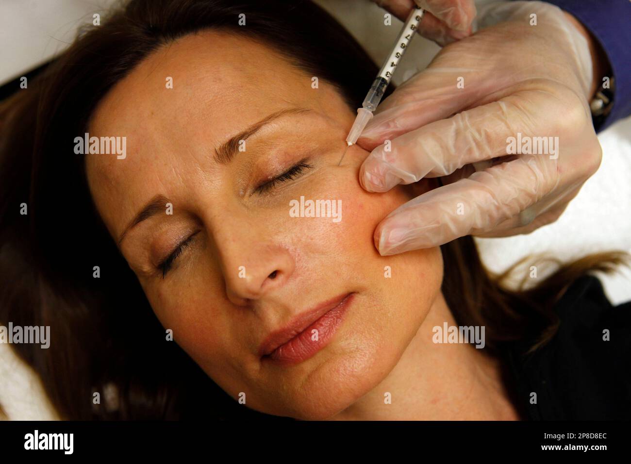 Colleen Delsack, 47, of Alexandria, Va., has Botox injected by Dr ...