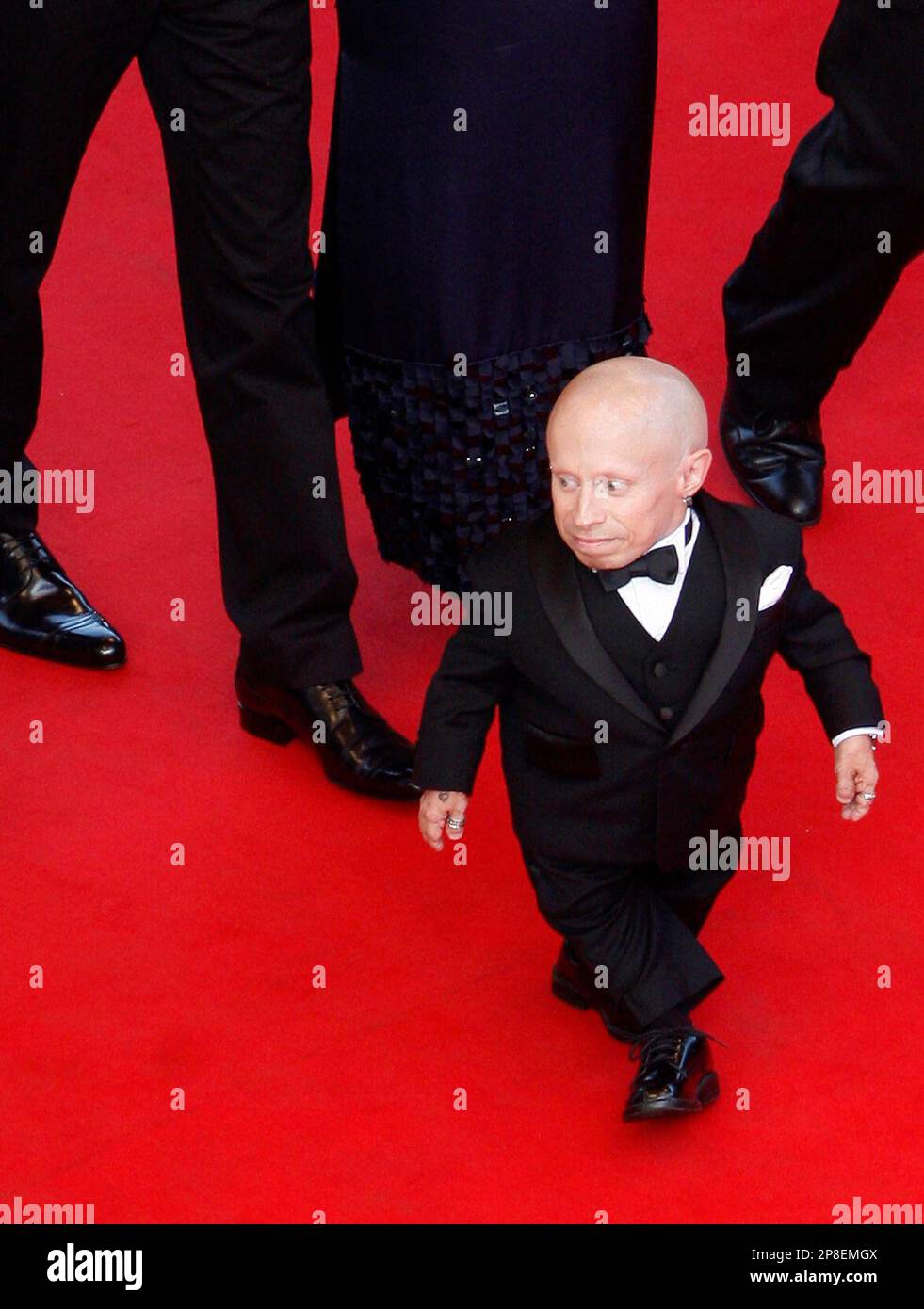 American actor Verne Troyer arrives for the screening of the film 'The ...