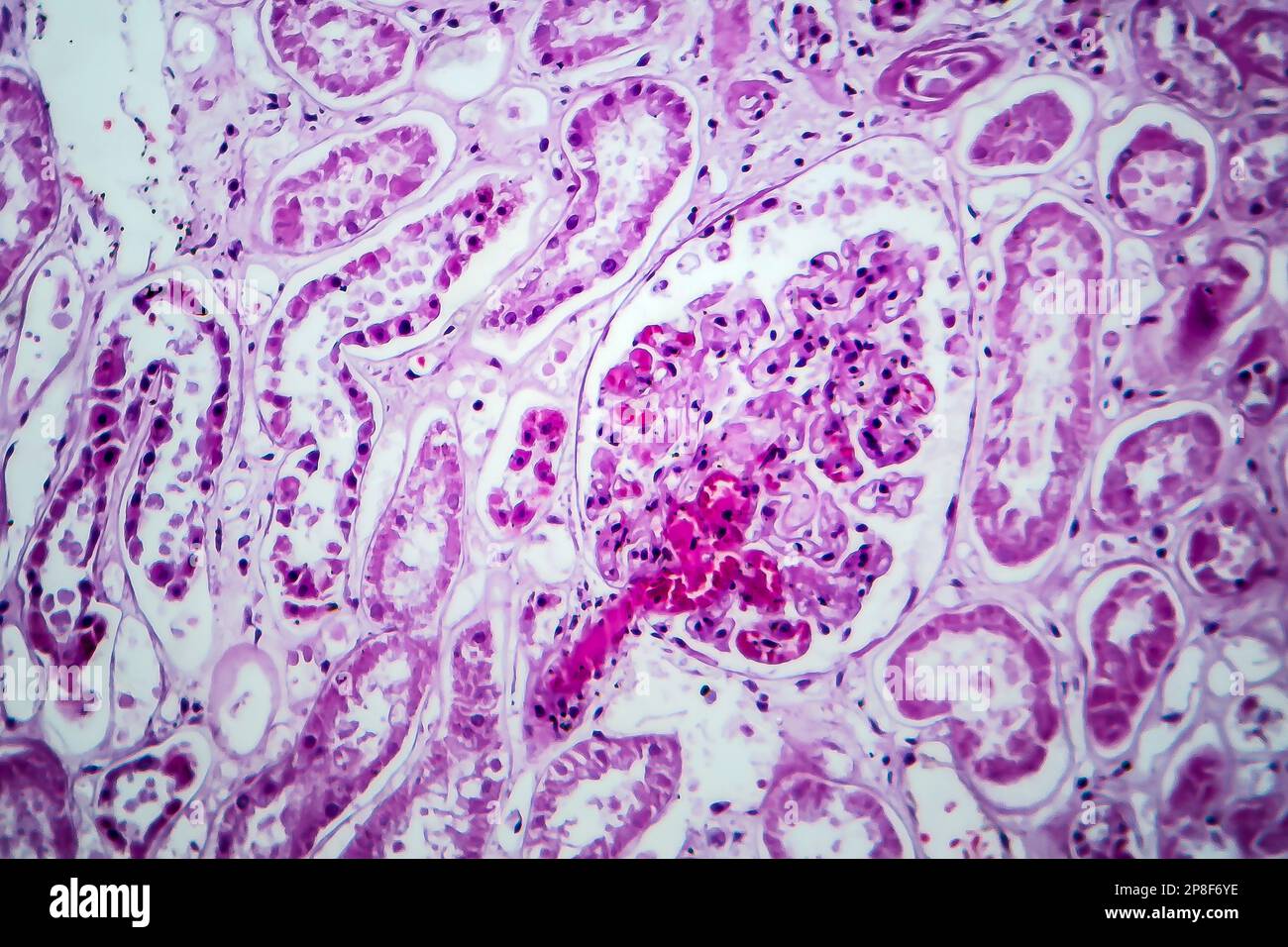 Autoimmune microscopy hi-res stock photography and images - Alamy