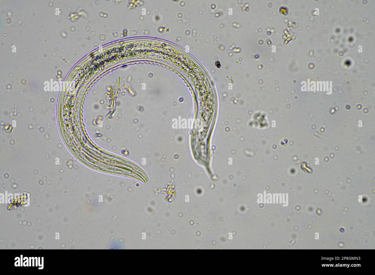 soil fungi, microorganisms and nematodes in a soil and compost sample ...