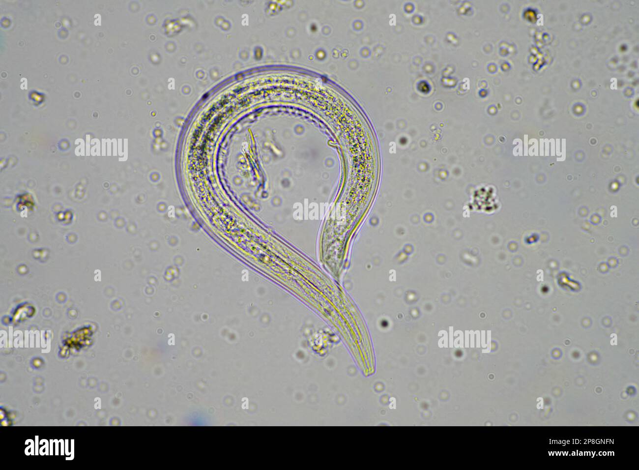 Internal parasite hi-res stock photography and images - Alamy